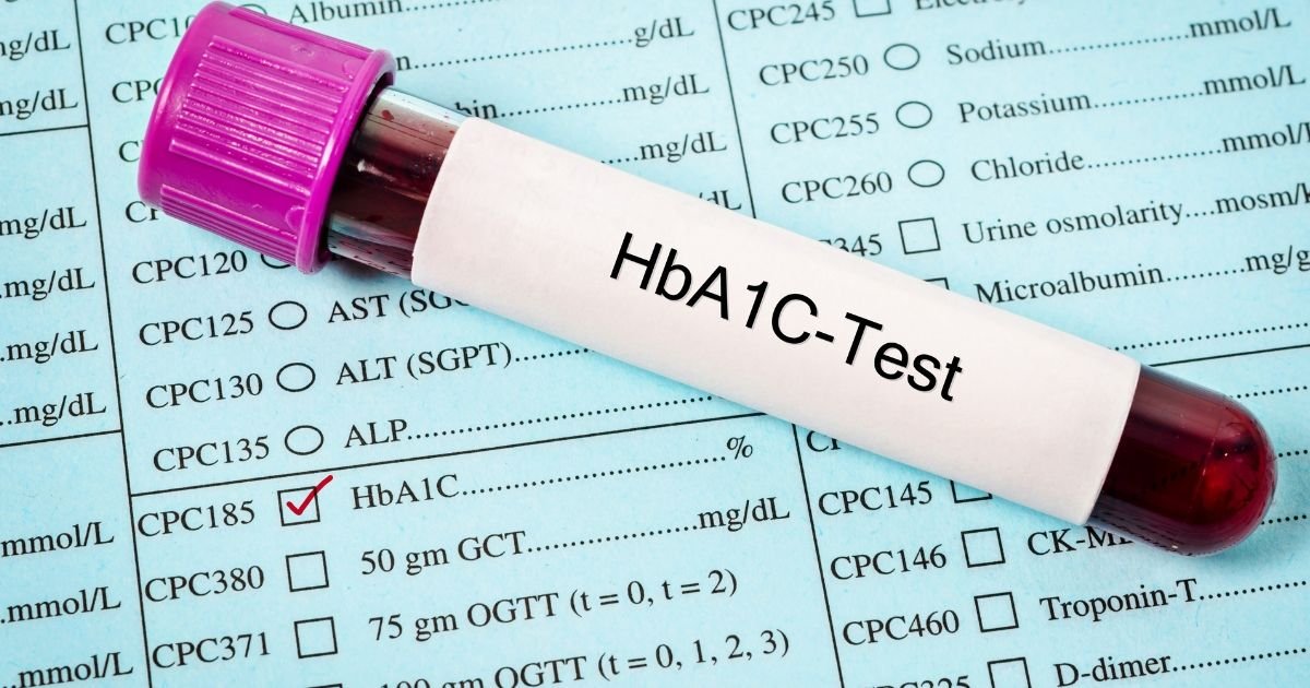 Hemoglobina Glicada (HbA1c): O Exame Essencial para Diabetes