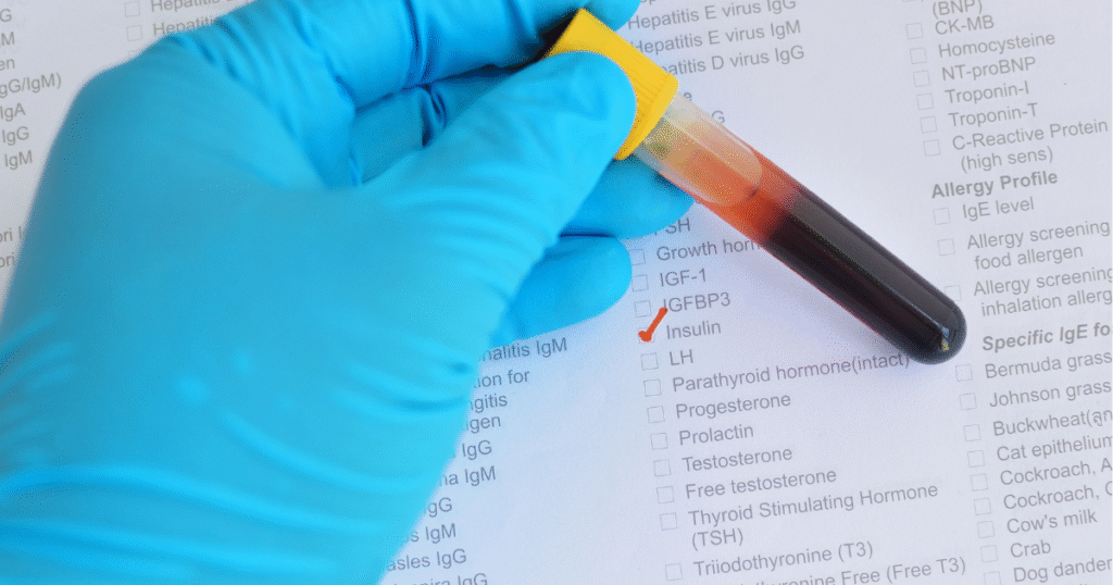 Glicemia: Entenda os Níveis de Glicose no Sangue.